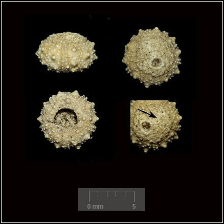 Sea urchin